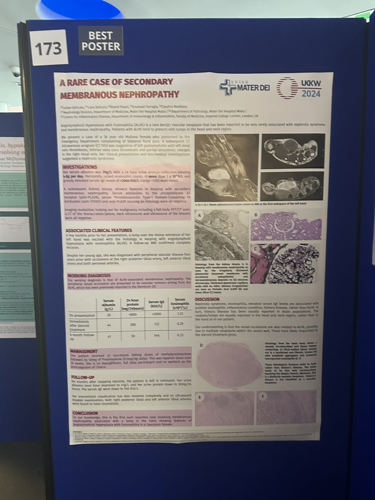 Posters - UK Kidney Week
